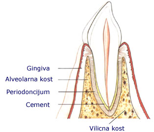Šta je parodontopatija? 7 najbitnijih pitanja za Stomatologa